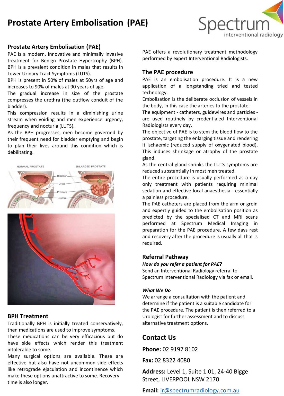 Prostate artery embolisation – available now – GP Voice