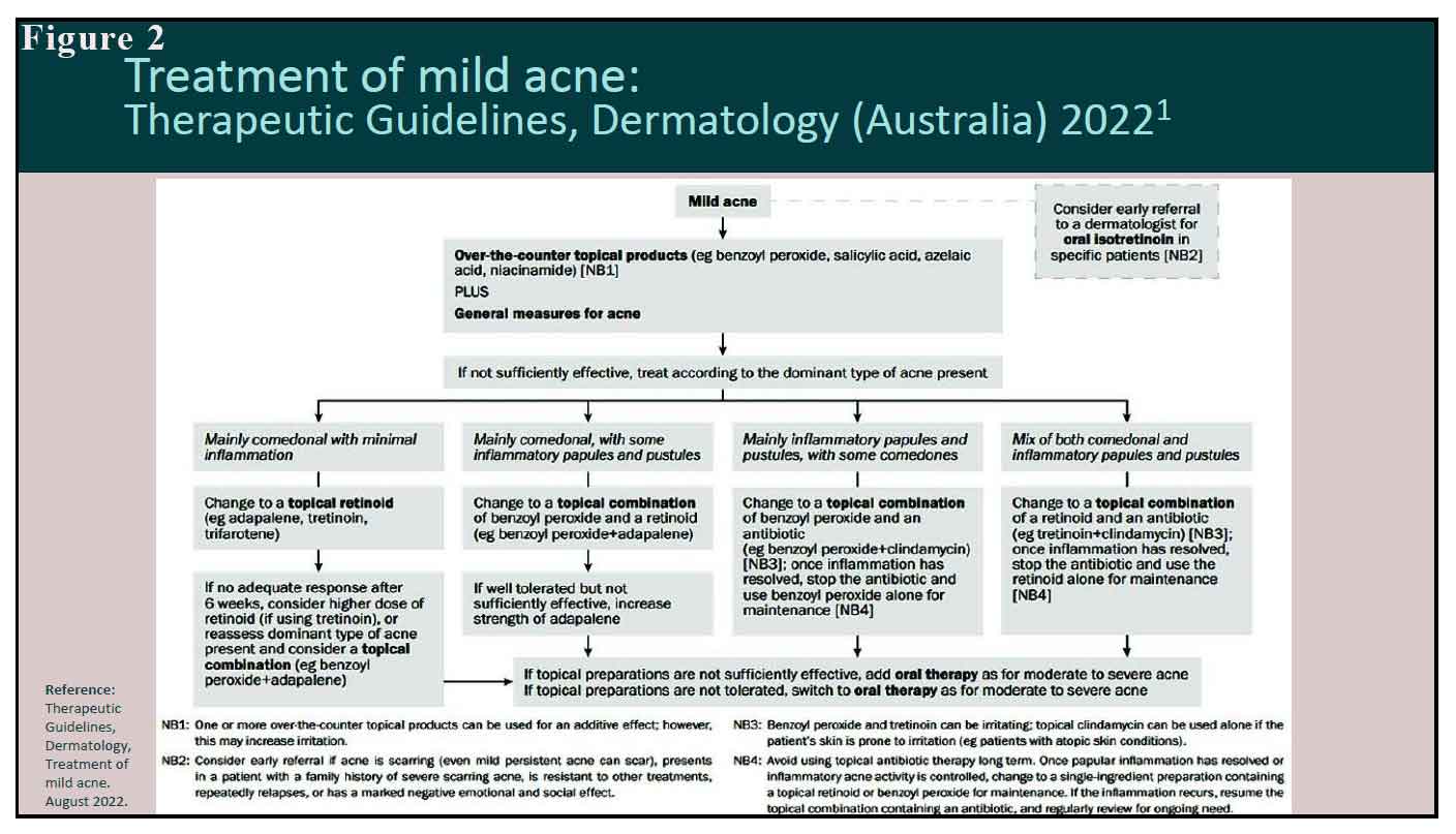 Acne – the ABC of management in primary care – GP Voice