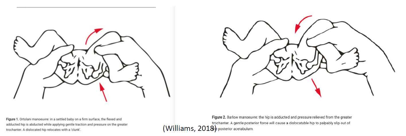 Paediatric ultrasound – developmental hip dysplasia – GP Voice